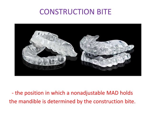 Role of mandibular advancement splint in sleep apnoea | PPTX | Ear ...