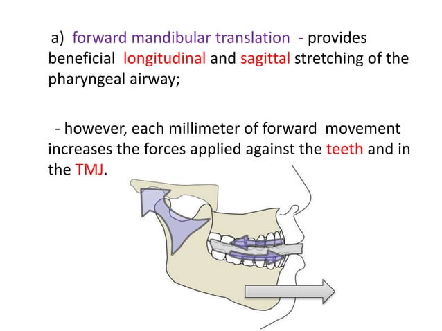 Role of mandibular advancement splint in sleep apnoea | PPTX | Ear ...