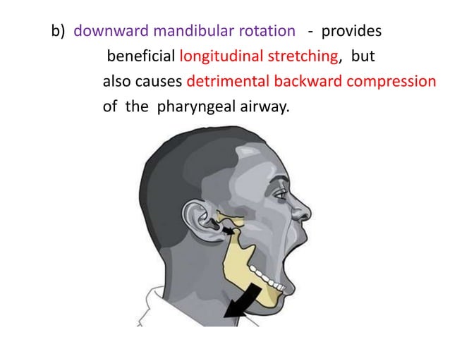 Role of mandibular advancement splint in sleep apnoea | PPTX | Ear ...