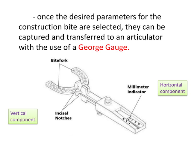 Role of mandibular advancement splint in sleep apnoea | PPTX | Ear ...