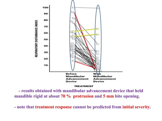 Role of mandibular advancement splint in sleep apnoea | PPTX | Ear ...