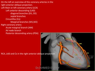 Role of MDCT in coronary artery part 1 (CT anatomy) Dr Ahmed Esawy | PDF