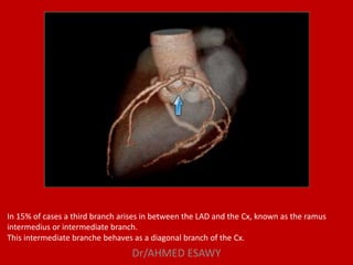 Role of MDCT in coronary artery part 1 (CT anatomy) Dr Ahmed Esawy | PDF