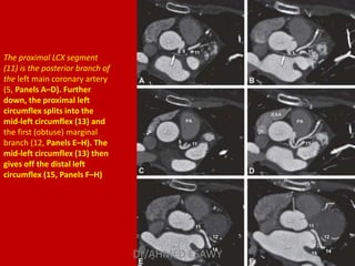 Role of MDCT in coronary artery part 1 (CT anatomy) Dr Ahmed Esawy | PDF