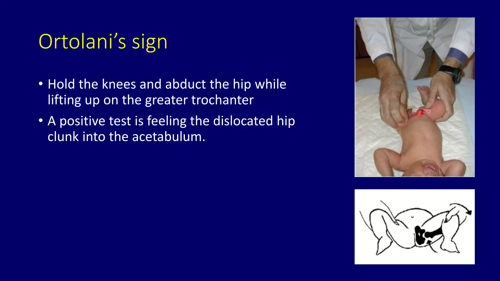 Role of medical imaging in developemental dysplasia of Hip Dr muhammad ...