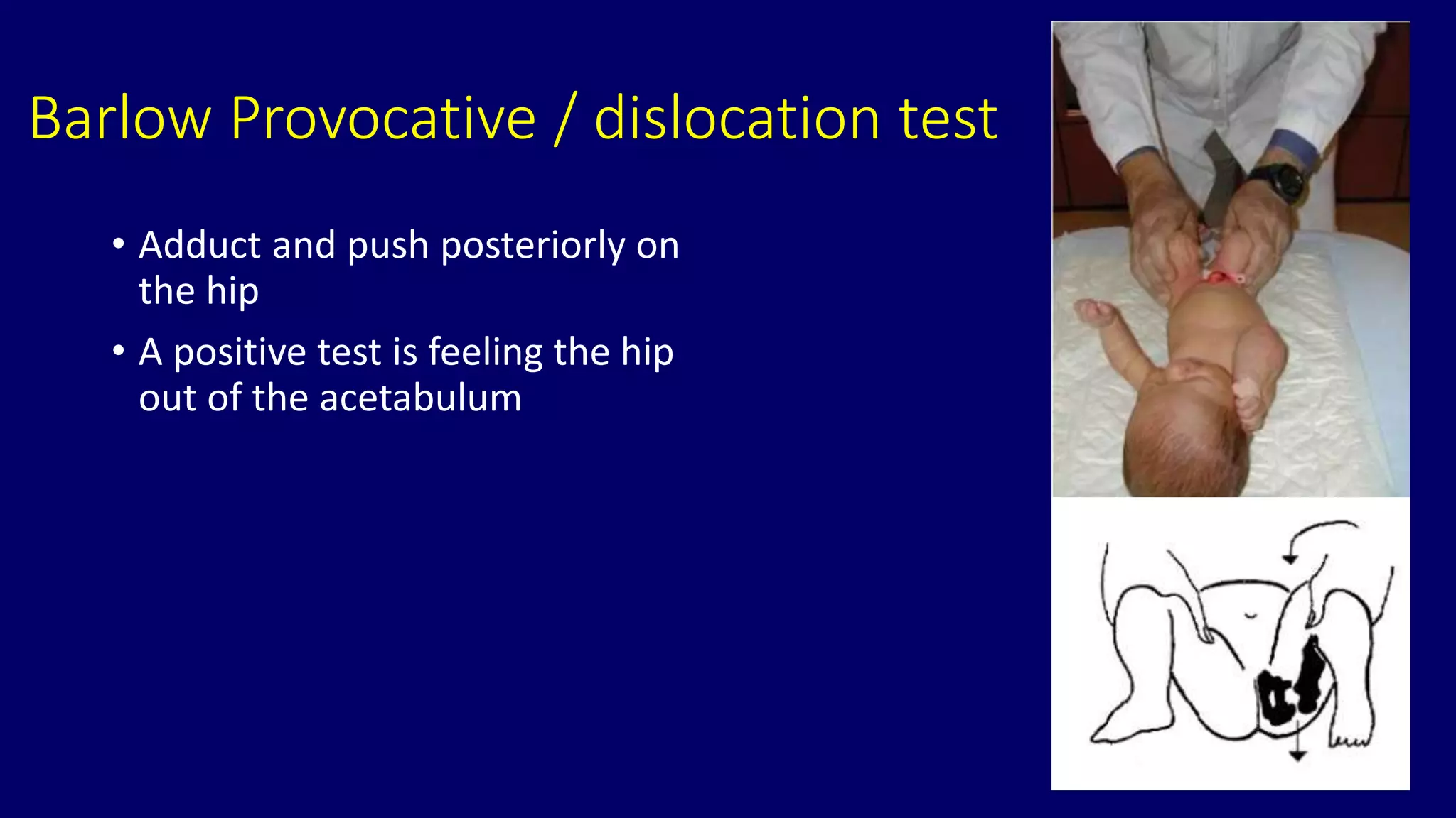 Role of medical imaging in developemental dysplasia of Hip Dr muhammad ...