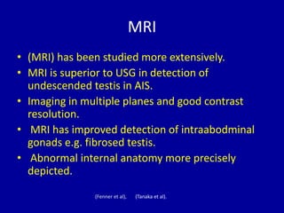 Role of medical imaging in diagnosing ais and presurgical assesment in ...