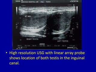 Role of medical imaging in diagnosing ais and presurgical assesment in ...