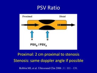 Role of medical imaging in management of arteriovenous fistula Dr ...