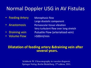 Normal Av Fistula