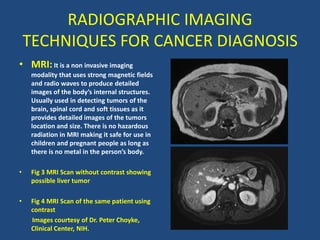 ROLE OF MEDICAL RADIOGRAPHY IN DIAGNOSIS AND TREATMENT OF CANCER_053146 ...