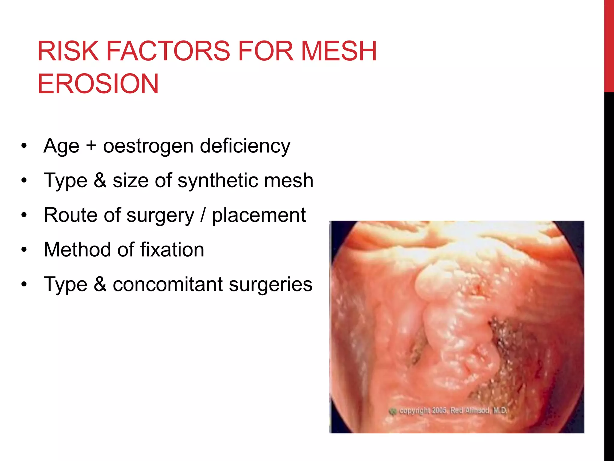 Role of mesh at current practice in urogynae | PDF