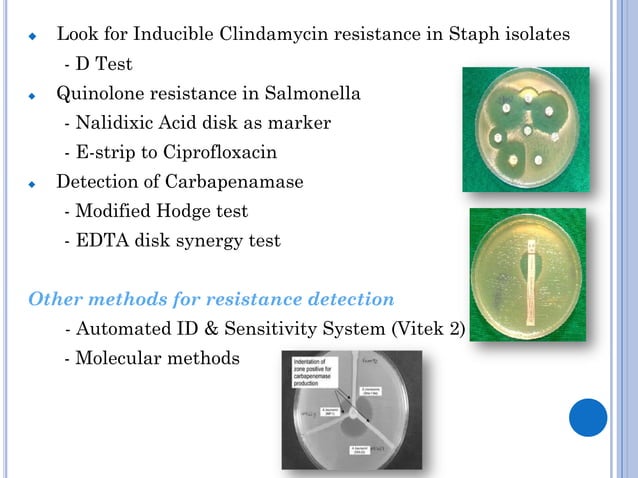 Role of Microbiology Labs in Infection Control | PDF