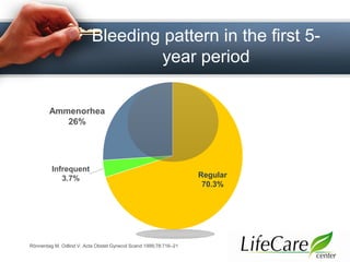 Role of mirena in heavy periods | PPT