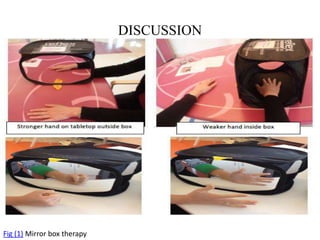 Role of mirror therapy in neurological conditions | PPTX