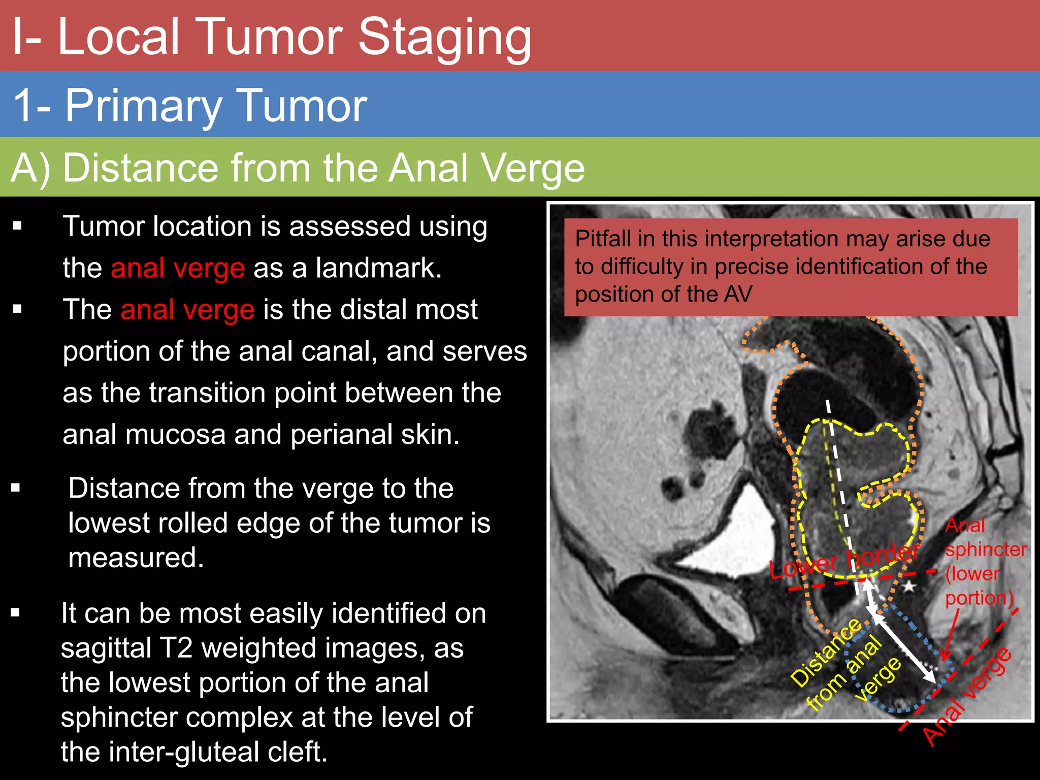 Role of mri in rectal carcinoma | PPTX
