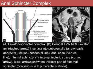 Role of mri in rectal carcinoma | PPTX
