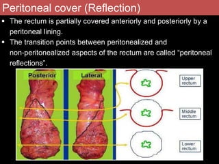 Role of mri in rectal carcinoma | PPTX
