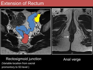 Role of mri in rectal carcinoma | PPT