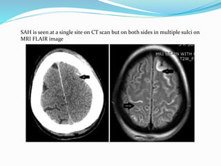 Role of mri in traumatic brain injury | PPT