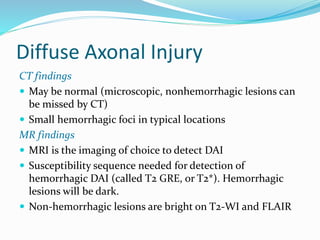 Role of mri in traumatic brain injury | PPT