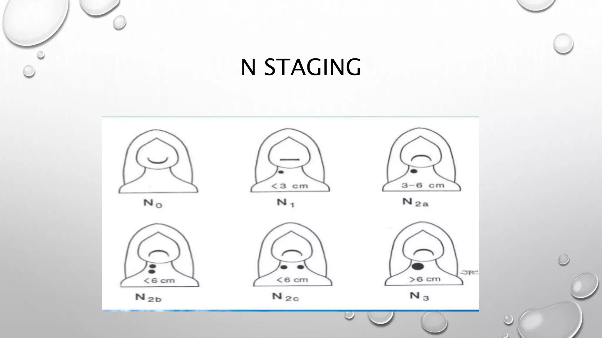 Role of neck dissection in the management of head and neck cancer | PPTX