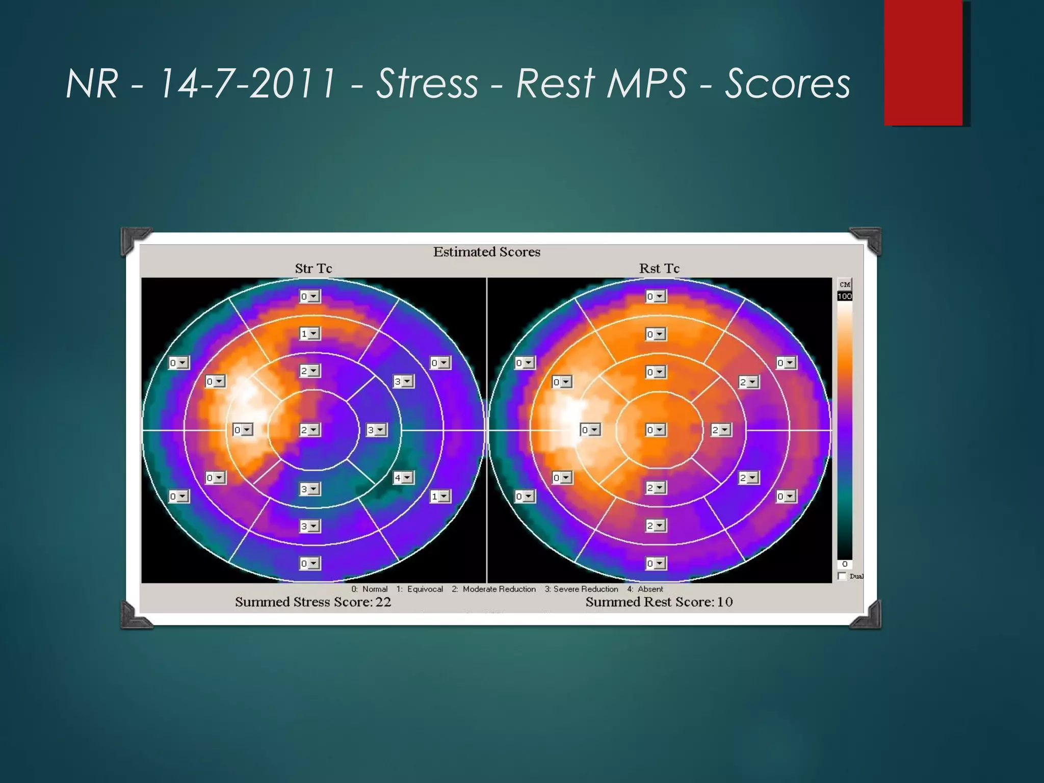Role of nuclear medicine | PPT