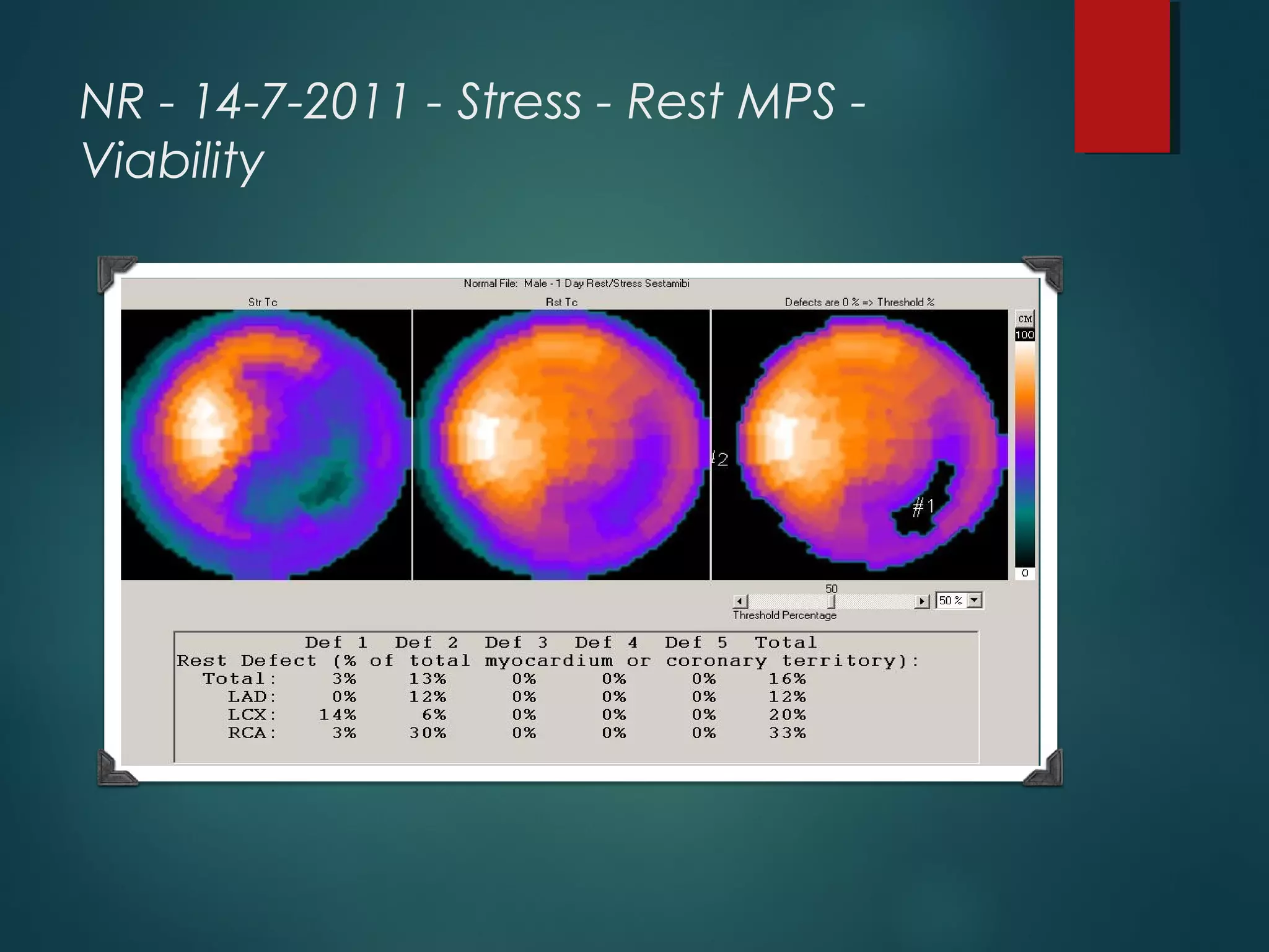 Role of nuclear medicine | PPT