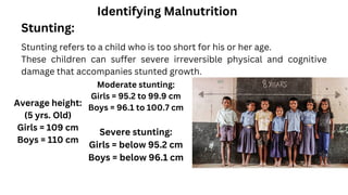 Role of Nutrition in Malnourished Children.pdf.pdf