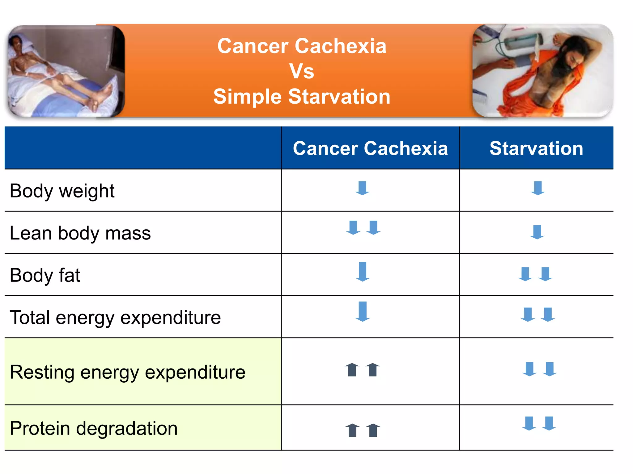 Role of nutrition in radiotherapy | PPTX