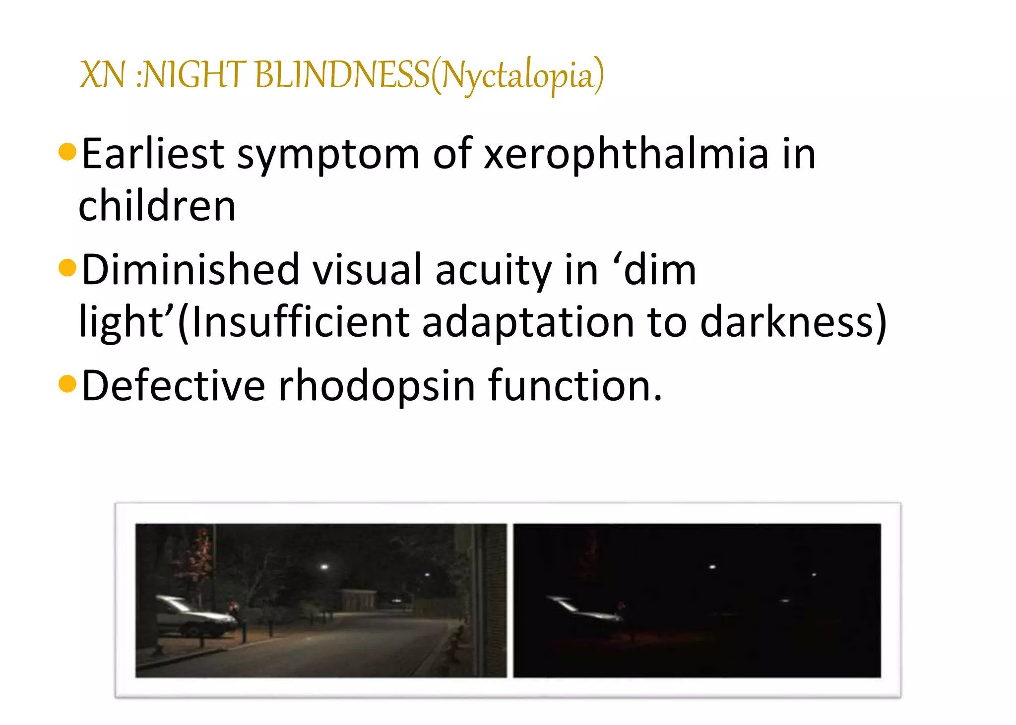 Role of nutrition to prevent ocular disorders | PPTX