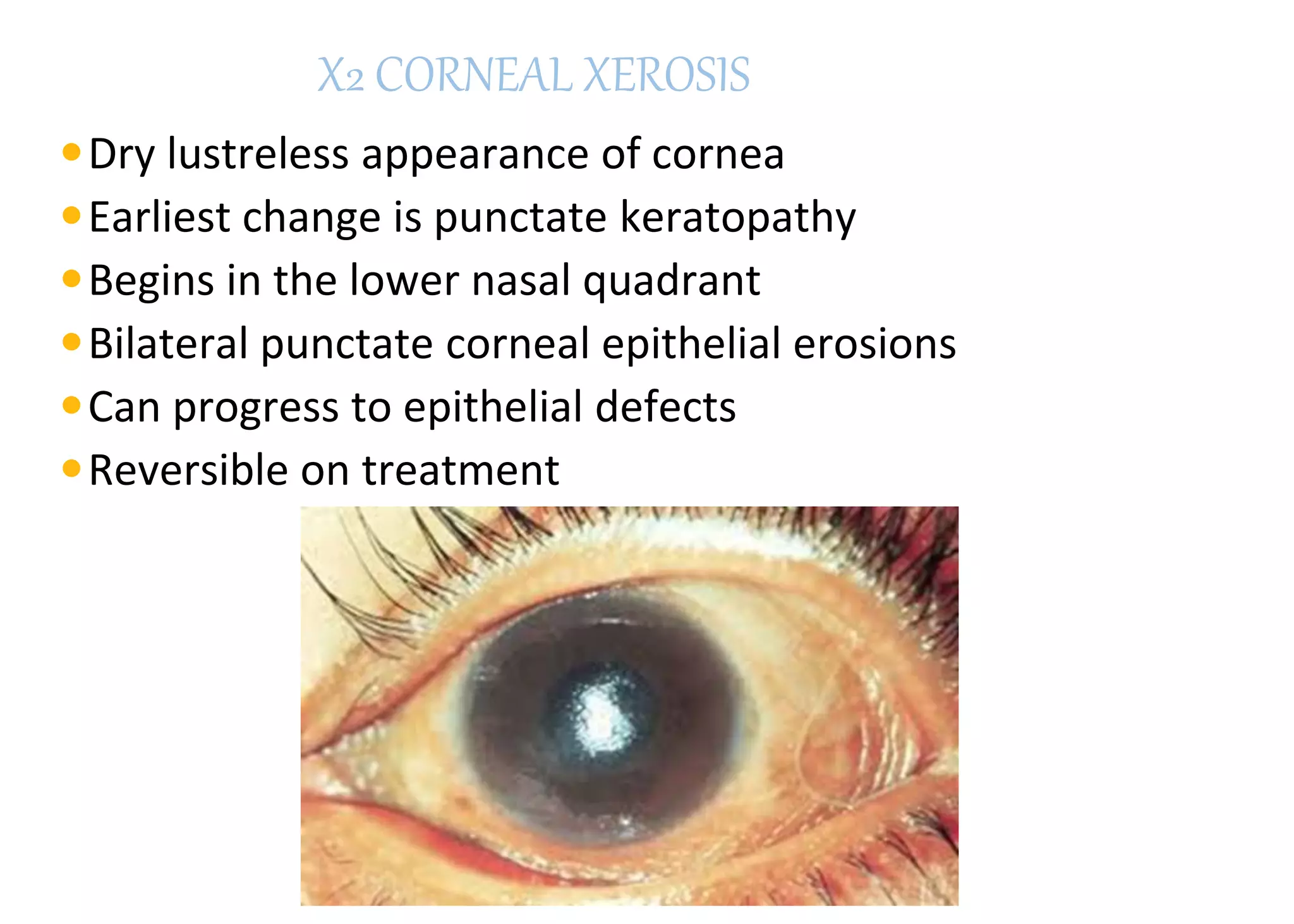 Role of nutrition to prevent ocular disorders | PPTX
