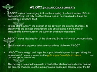 Role of oct in glaucoma | PPTX