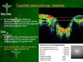 Role of oct in glaucoma | PPTX