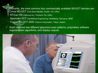 Role of oct in glaucoma | PPTX