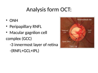 Role of OCT in the Glaucoma patients.pptx