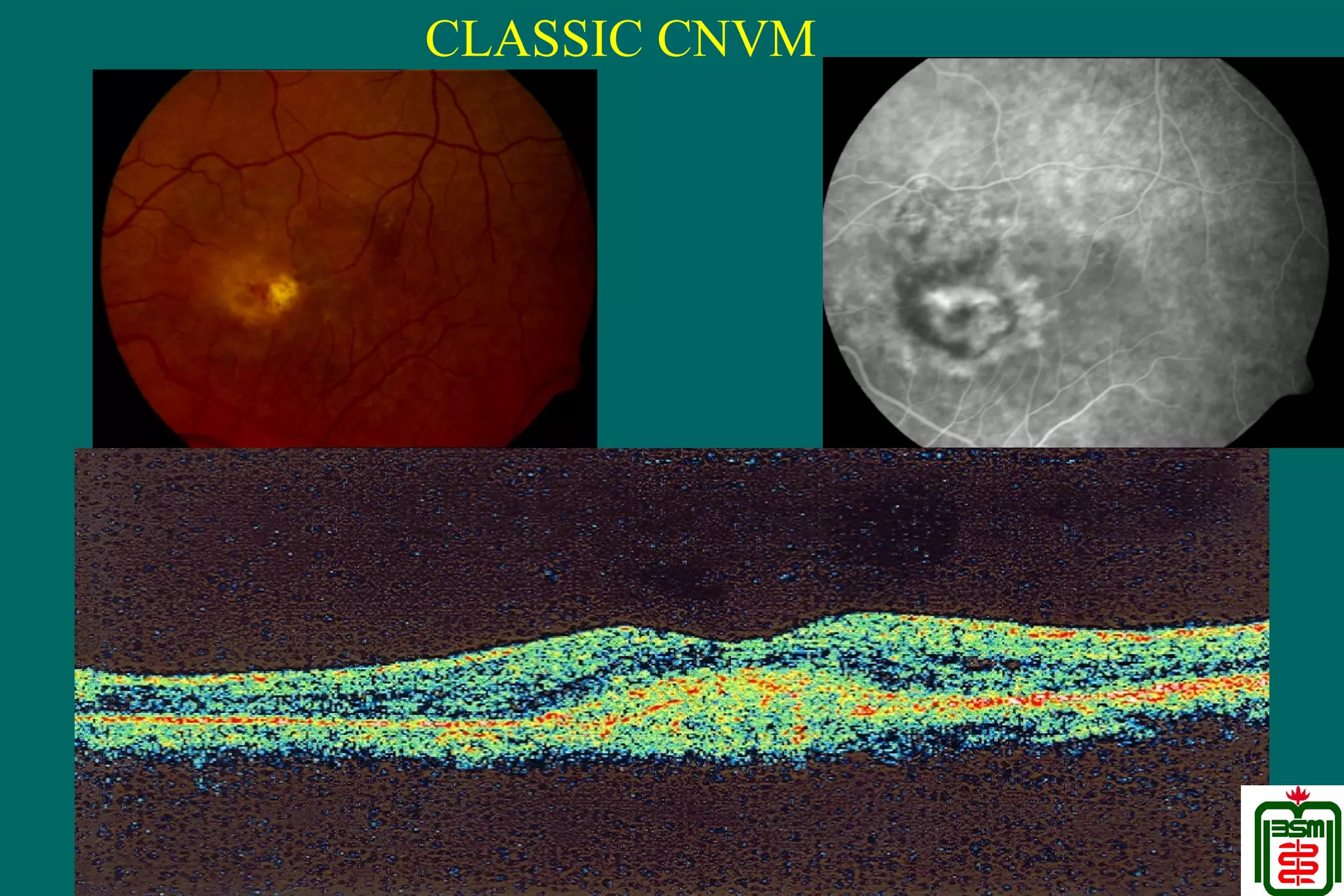 Optical Coherence Tomography (OCT) | PPT
