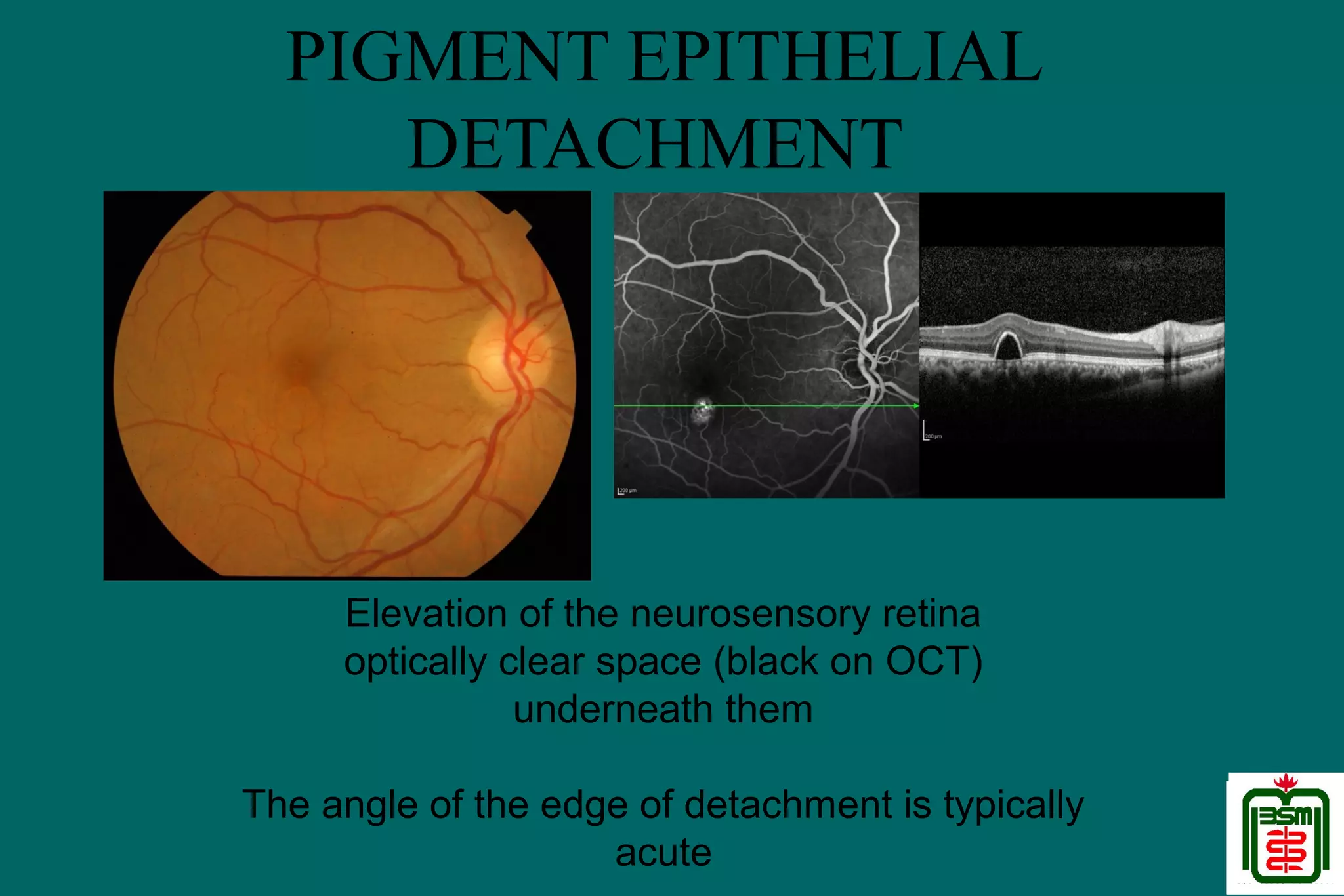 Optical Coherence Tomography (OCT) | PPT