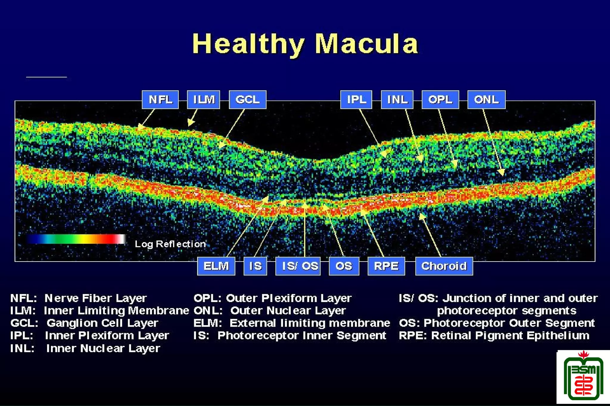 Optical Coherence Tomography (OCT) | PPT
