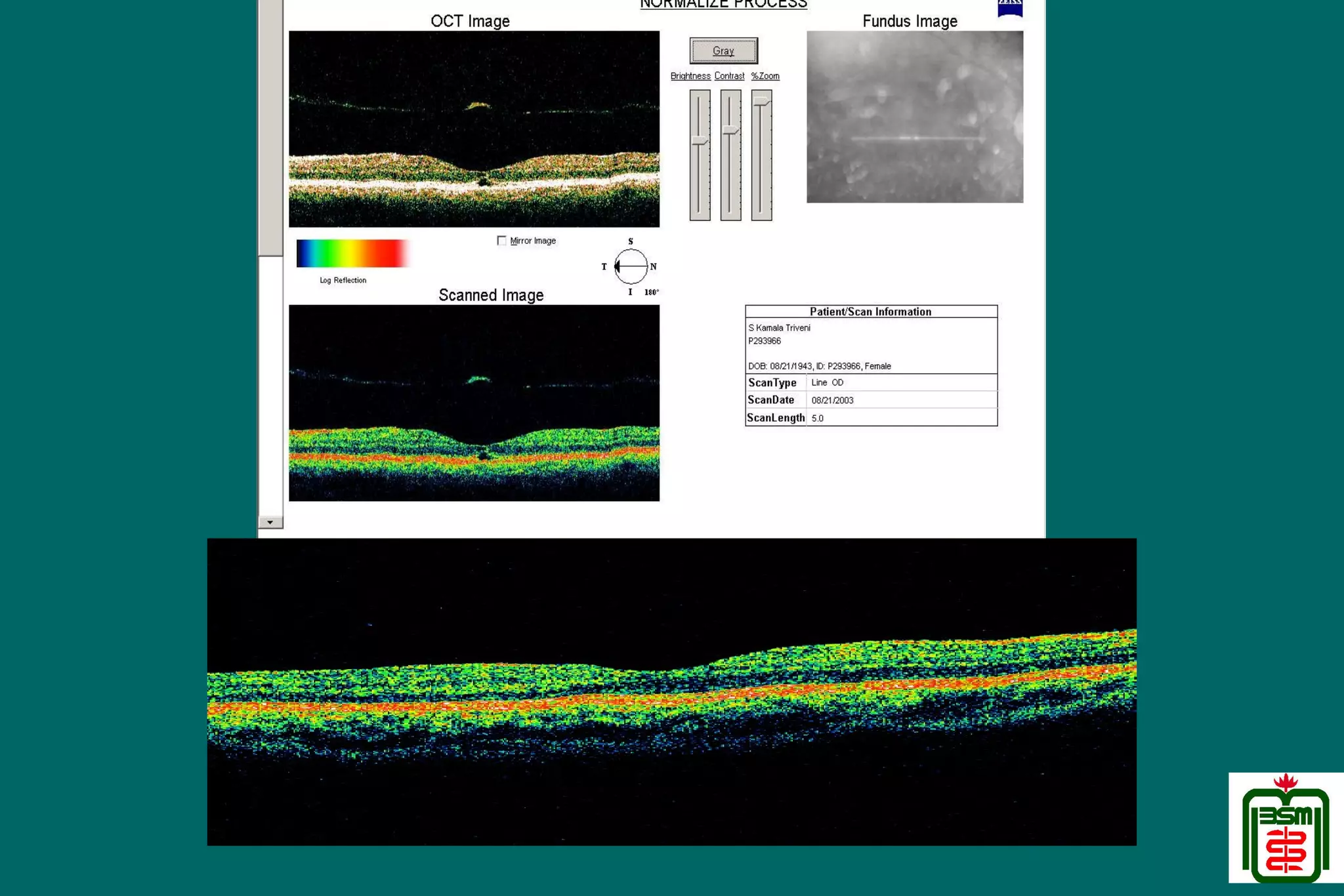 Optical Coherence Tomography (OCT) | PPT