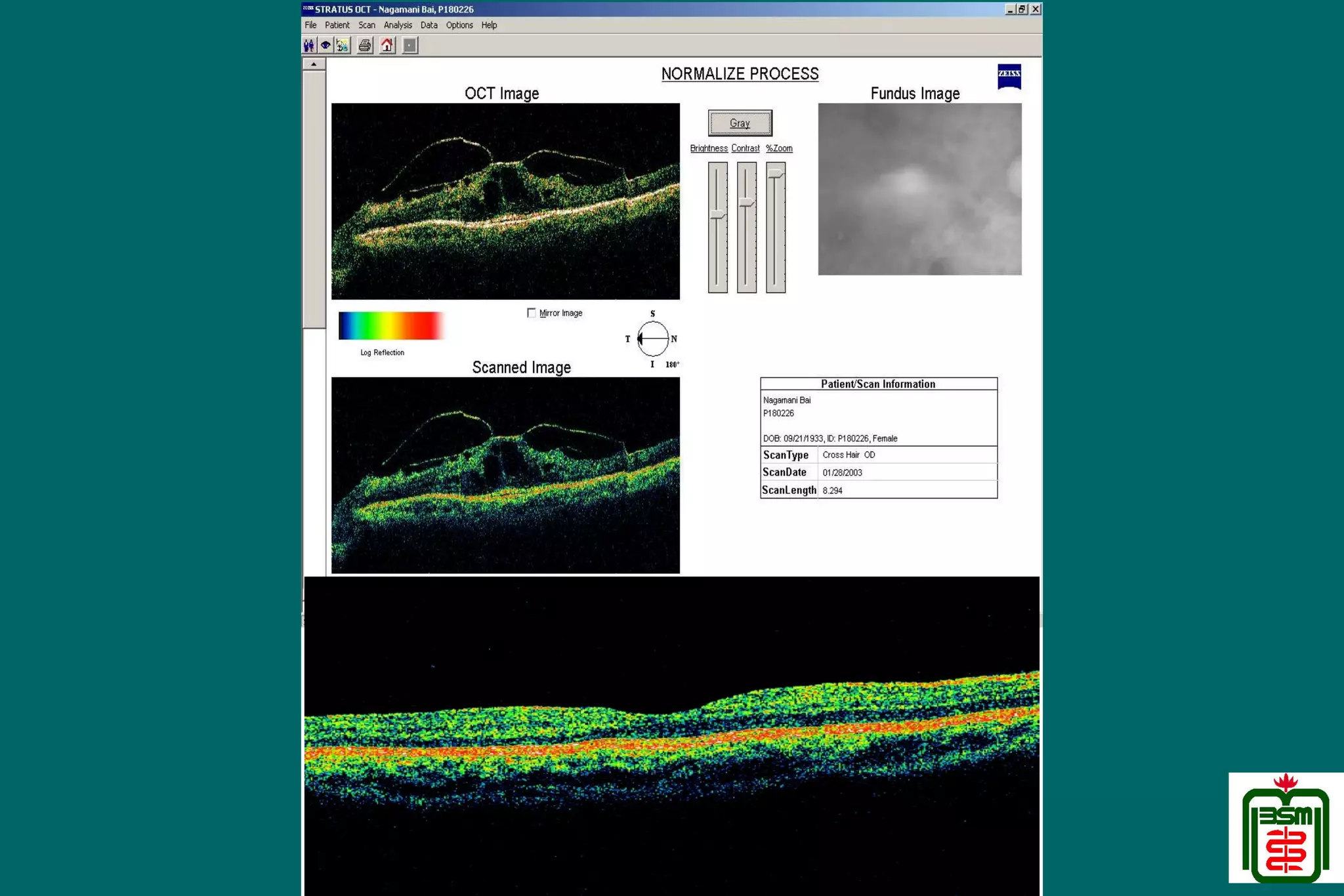 Optical Coherence Tomography (OCT) | PPT