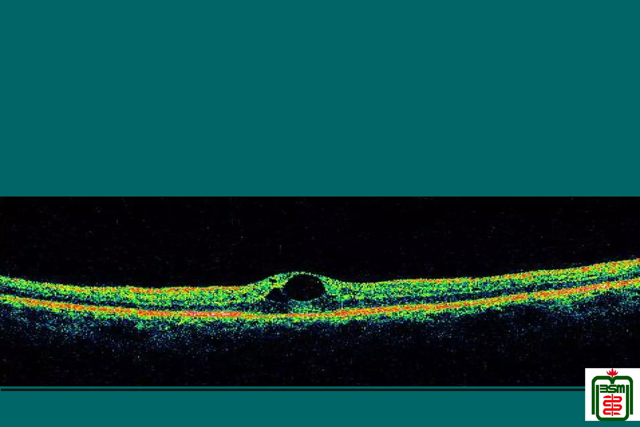 Optical Coherence Tomography (OCT) | PPT