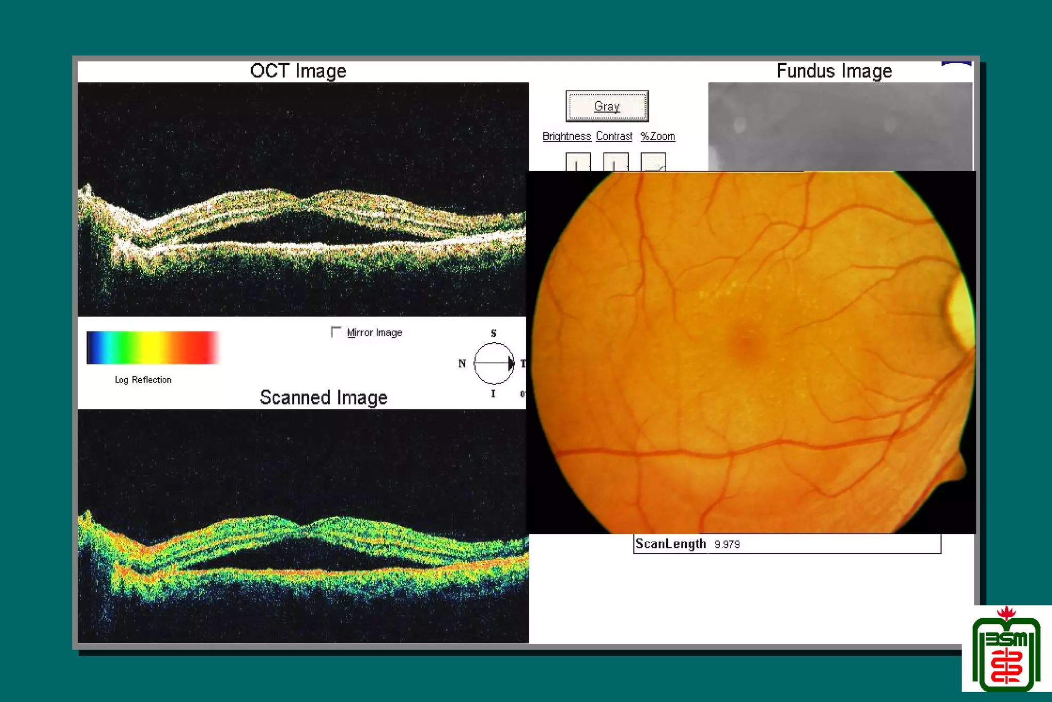 Optical Coherence Tomography (OCT) | PPT