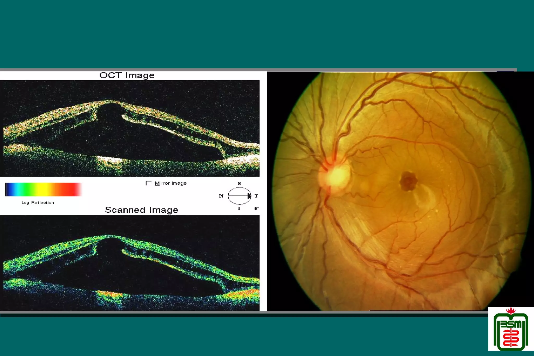 Optical Coherence Tomography (OCT) | PPT