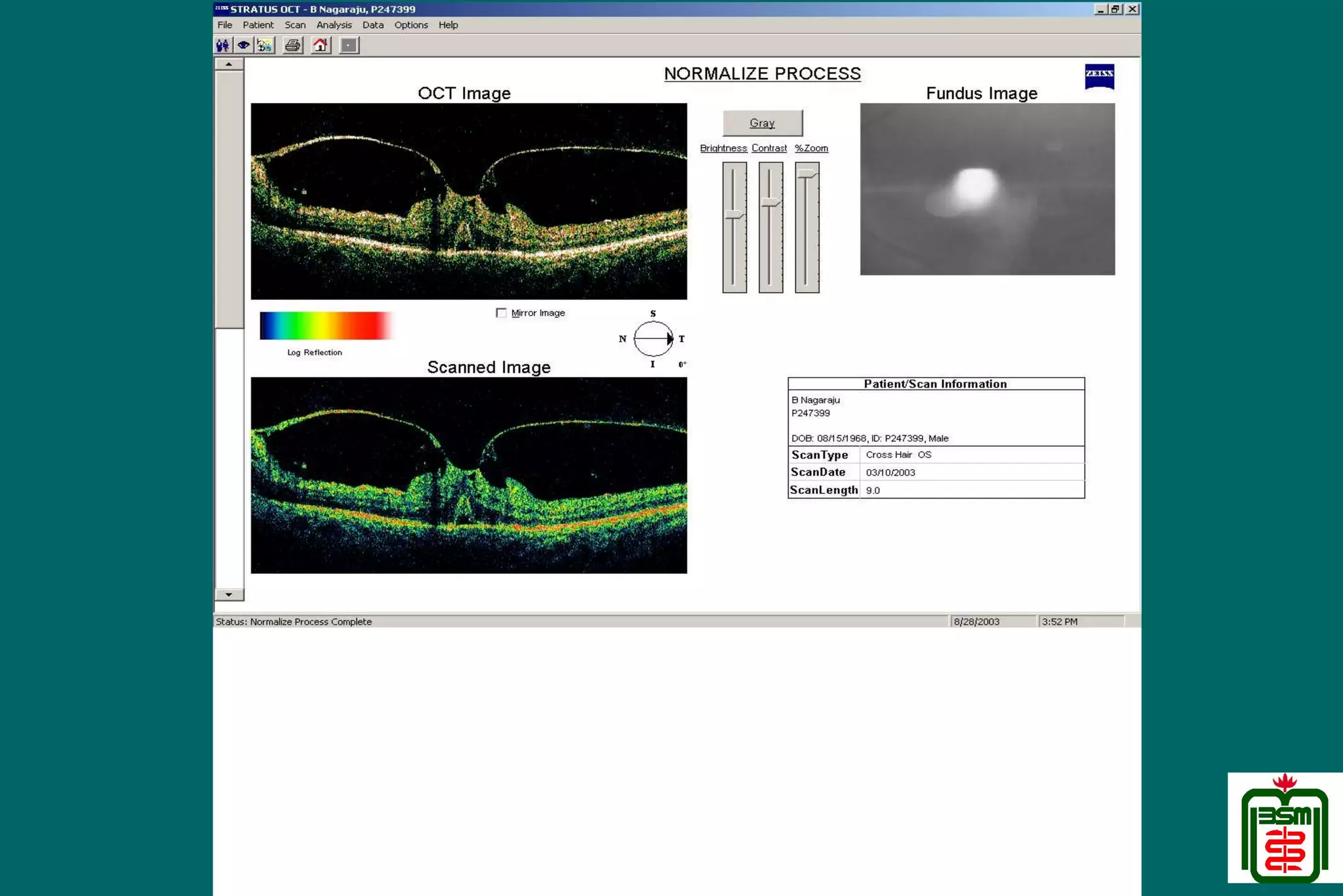 Optical Coherence Tomography (OCT) | PPT