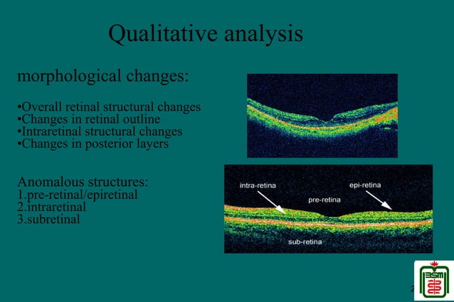 Optical Coherence Tomography (OCT) | PPT