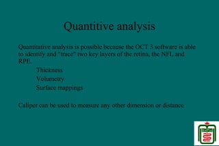 Optical Coherence Tomography (OCT) | PPT