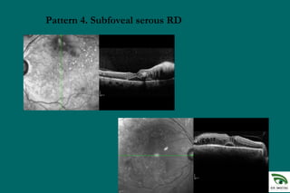Optical Coherence Tomography (OCT) | PPT