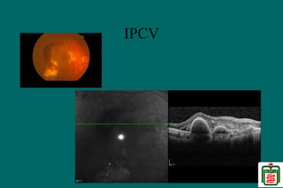Optical Coherence Tomography (OCT) | PPT