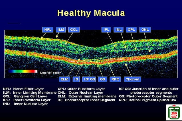 Optical Coherence Tomography (OCT) | PPT